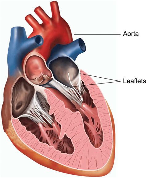 Mitral Valve Stenosis