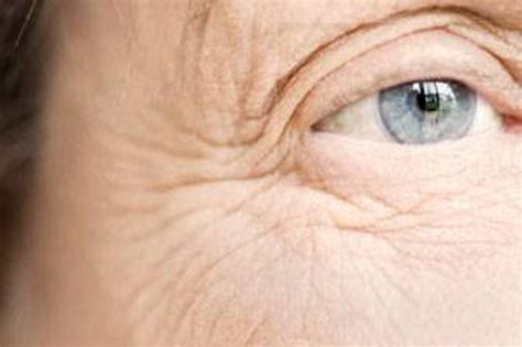 Tratamiento Para Las Patas De Gallo En Los Ojos Consejos Ojos