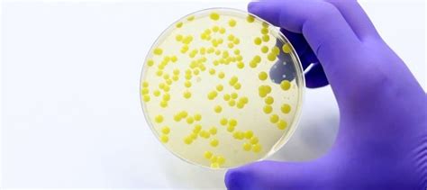 Usp61 Microbial Enumeration Tests