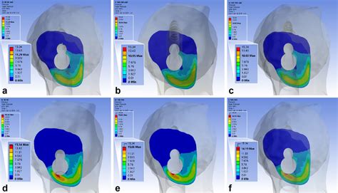 Band Graphs Depicting The Interfragmentary Compression The Results Download Scientific Diagram