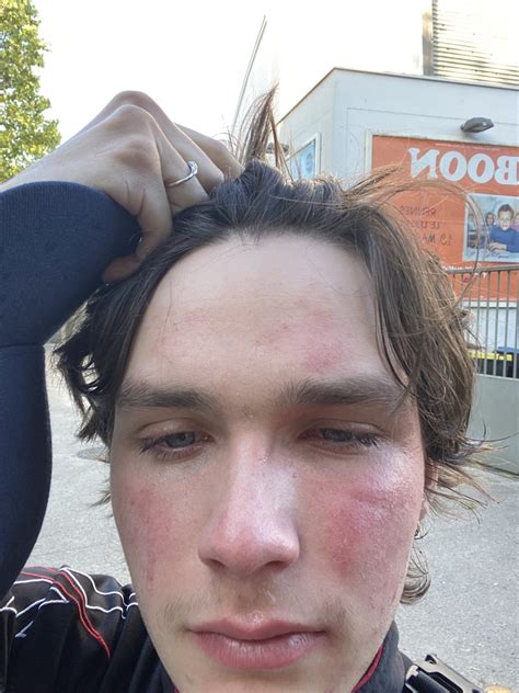 William Schnabels Instagram Twitter And Facebook On Idcrawl