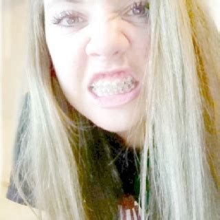 Brace Face Brace Face Face My Style