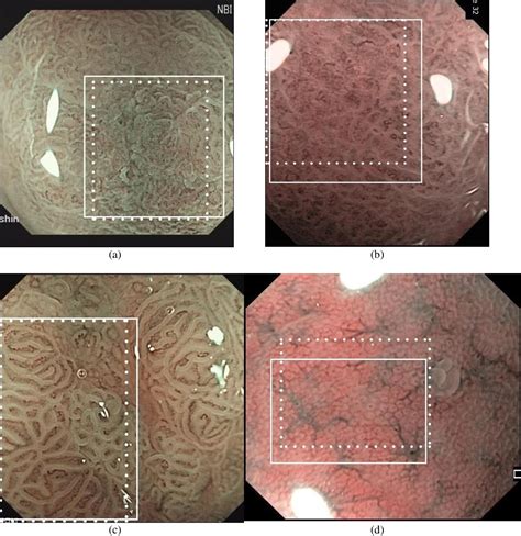 Figure 4 From Deep Learning For Gastric Pathology Detection In Endoscopic Images Semantic Scholar