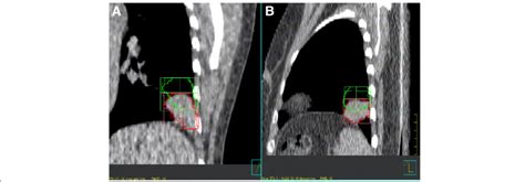 Phase 0 Of Four Dimensional Computed Tomography 4dct Image For An
