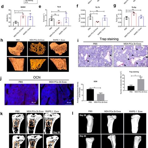 Schematic Depiction Of Our Work Pca Exosomes Regulate Bone
