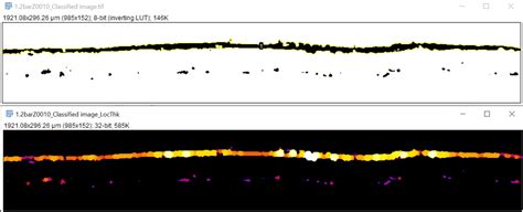 Calculating Area Of Segmented Image Image Analysis Imagesc Forum