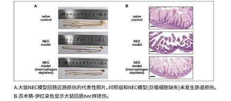 云克隆坏死性小肠结肠炎 Nec 大鼠模型助力揭示rac1介导的抑制新生儿m1巨噬细胞中细胞因子表达的新途径 知乎