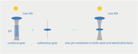 FF OCT Technology Apollo Medical Optics Ltd