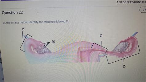 Solved Question 22 In The Image Below Identify The Chegg Com