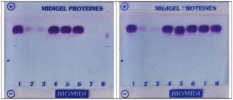一种硫酸软骨素钠中生物大分子的琼脂糖凝胶电泳检测方法与流程