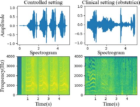 Figure 1 From A Scene Adaption Framework For Infant Cry Detection In Obstetrics Semantic Scholar