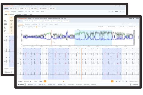 Advanced Holter Analysis Software For Ecg Machines In Uae
