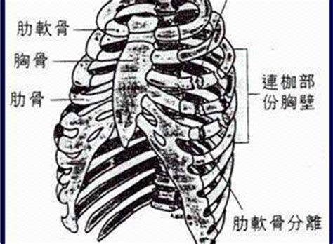肋骨重叠错位的图片 肋骨图片位置图 大山谷图库