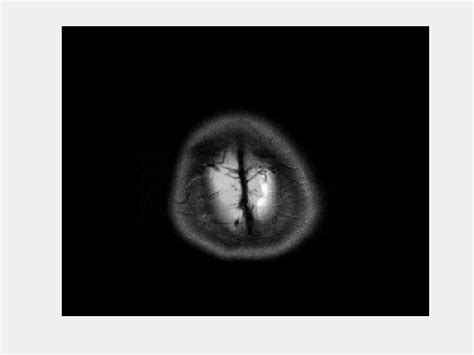 MRI Data Visualization MATLAB For MRI Applications