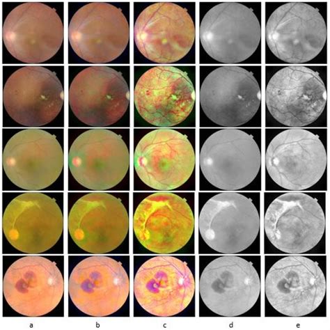 A Input Image In Rgb Color Space B Output Of Stage 1 C Output Of Download Scientific