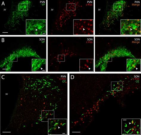 Dual Label Immunofluorescence Of C Fos With Vasopressin Or Oxytocin