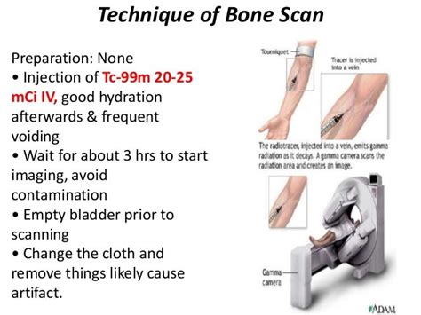 Bone Scan In Orthopaedics