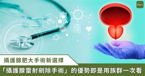 攝護腺肥大微創新選擇！認識水蒸氣消融手術、手術方法、適合族群與治療優勢 蕃新聞