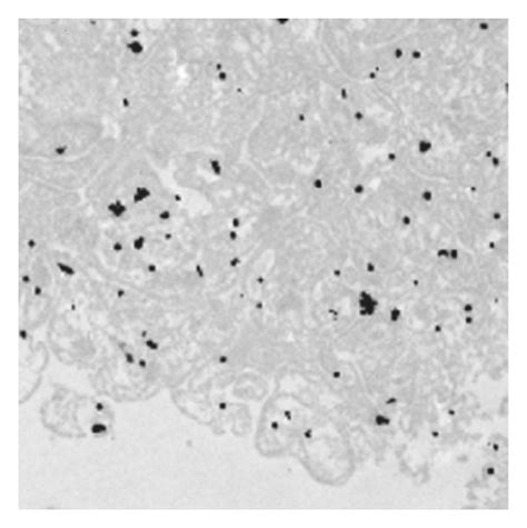 Silver Enhancement Preembedding Using Immunoelectron Microscopy In