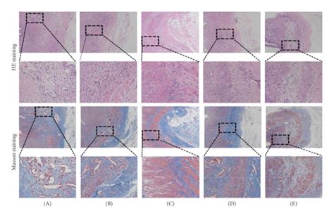 Histological Analysis Of Newly Formed Tissues Within The Defect Regions