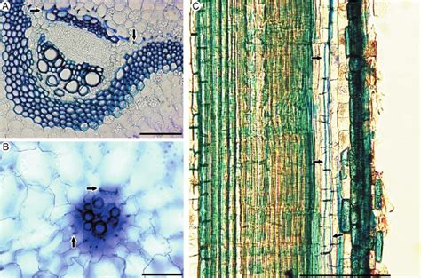 Stem Endodermis With A Casparian Band In Piperaceae A Piper Download Scientific Diagram