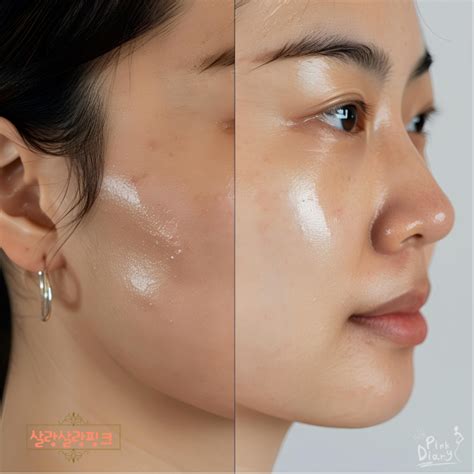 봄 철 건조한피부 피부속건조 보습제 마유크림 사용해요 네이버 블로그