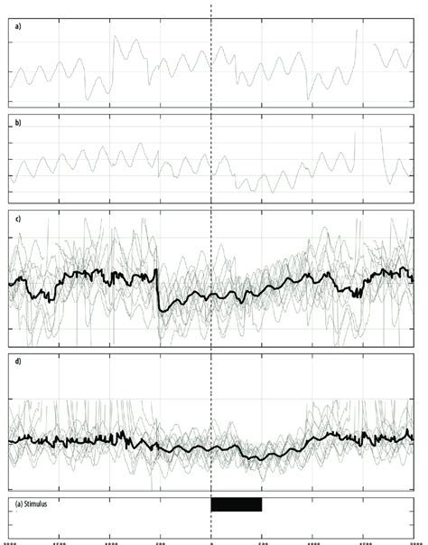 Video Oculography Findings Of The Right Eye During The First Session Download Scientific