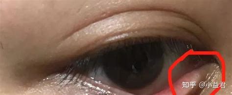 为什么有的人滴眼药水嗓子会苦苦的 知乎