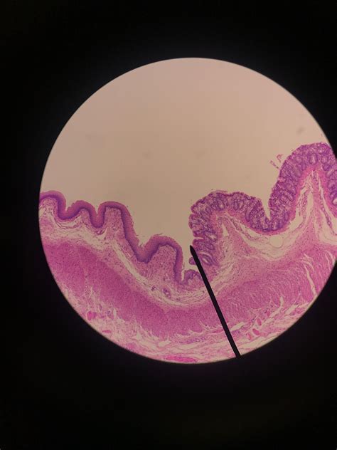 Best 12 Trachea Pseudostratified Columnar Epithelium Artofit
