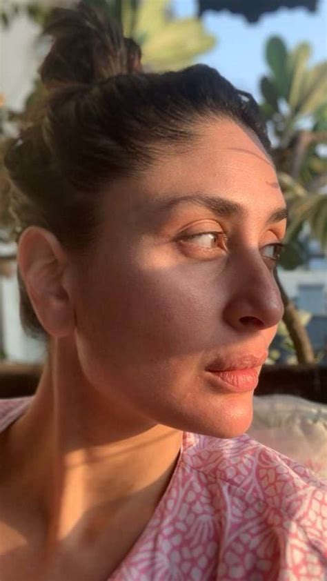 Ways To Naturally Treat Sunburn During The Summers Sunburn Home