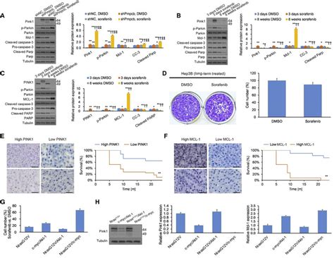 MCL Expression Positively Correlates With Poorer Response To