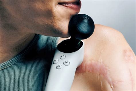 Microsofts Xbox Adaptive Joystick Is Now Available The Verge