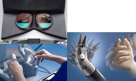 Robotic Surgery Putting An End To Fear Of Surgery Miot International