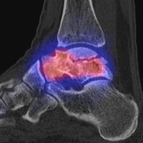 H Christian Rischke On Linkedin Secondopinion Precision