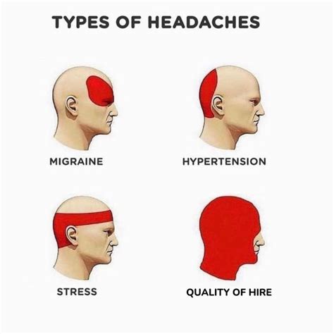 James Kaye On Linkedin Devops Devopsengineers Softwaredevelopment