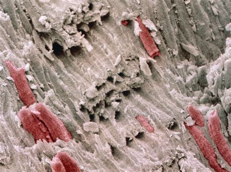 Coloured Sem Of Human Tooth Enamel Stock Image P486 0031 Science Photo Library