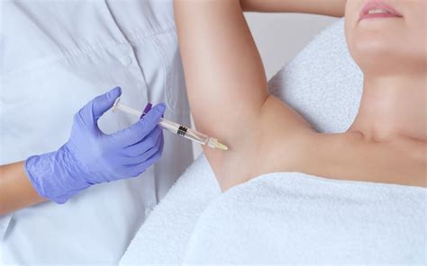 Botox For Axillary Hyperhidrosis Excess Underarm Sweating