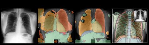 Qualitative Segmentation Results On Extended Anatomical X Ray Annotations Download Scientific