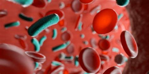 What Are The 3 Stages Of Sepsis Salvi Schostok And Pritchard Pc