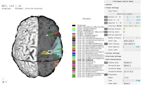 Your Advanced Brain Viewer For Python
