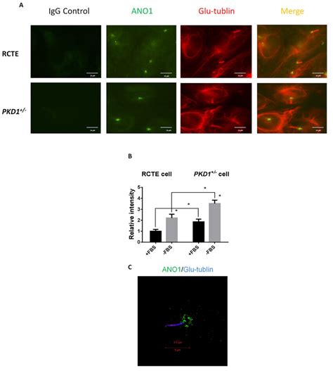 Ano1 Is Localized In Primary Cilia Ab Immunofluorescence Staining