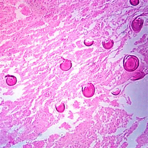 Sponge Slide Labeled At Richard Peay Blog