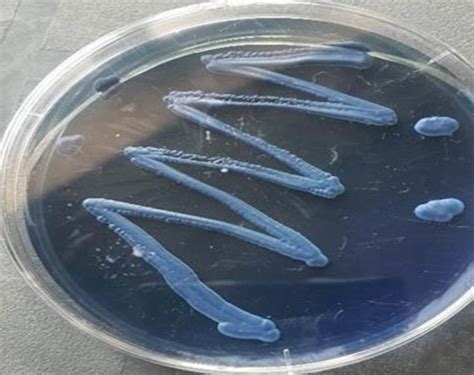 Growth Of C Neoformans On Cryptococcus Differential Agar After 10 Days Download Scientific