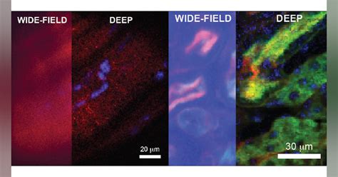 computational and nir imaging increase wide field microscopy depth and resolution at increased