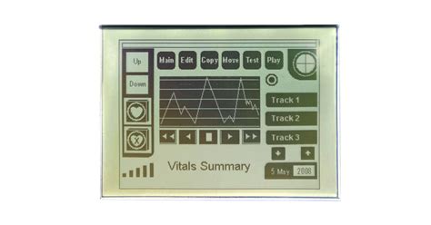 FSTN Monochrome LCD Display Anders Electronics