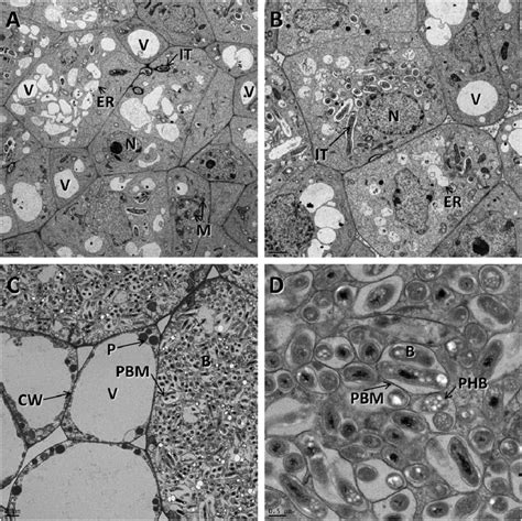 Transmission Electron Micrographs Of Soybean Genotype Bay Nodules A