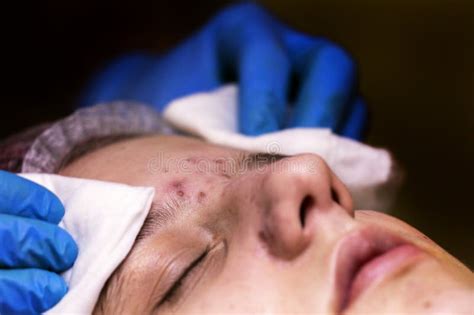 Close Up Of A Happy Teenager Girl On A Procedure At A Beautician