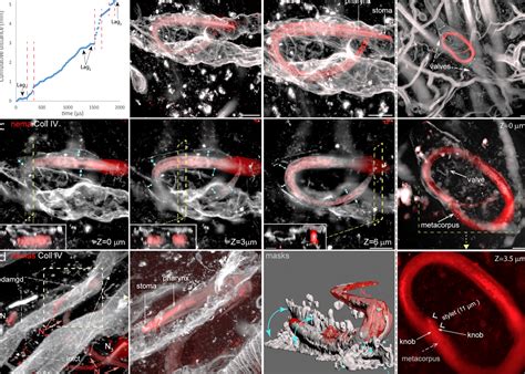 Parasitic Worms In Human Skin