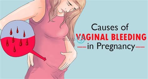 Vaginal Bleeding Dr Wael Elbanna د وائل البنا