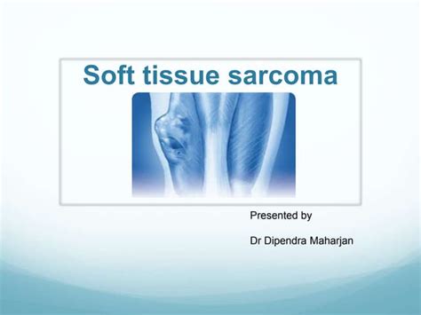 Soft Tissue Sarcoma Pdf Cancer Diseases And Conditions